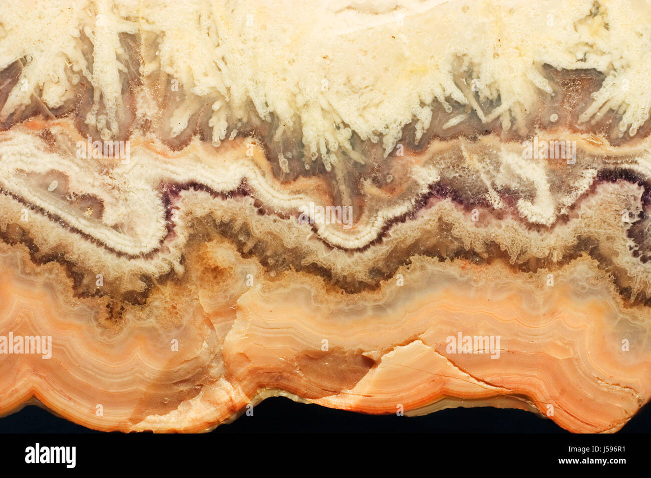 Lithotomy hi-res stock photography and images - Alamy