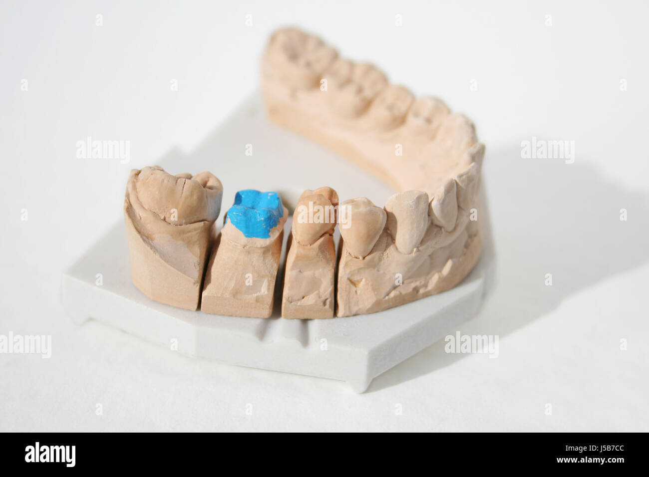 plaster model mandible Stock Photo - Alamy