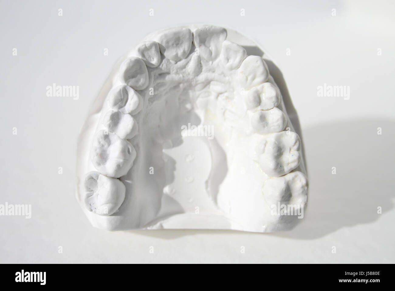 plaster model of the upper jaw Stock Photo - Alamy