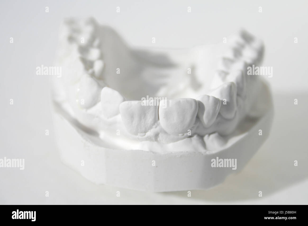 Maxillary hi-res stock photography and images - Alamy