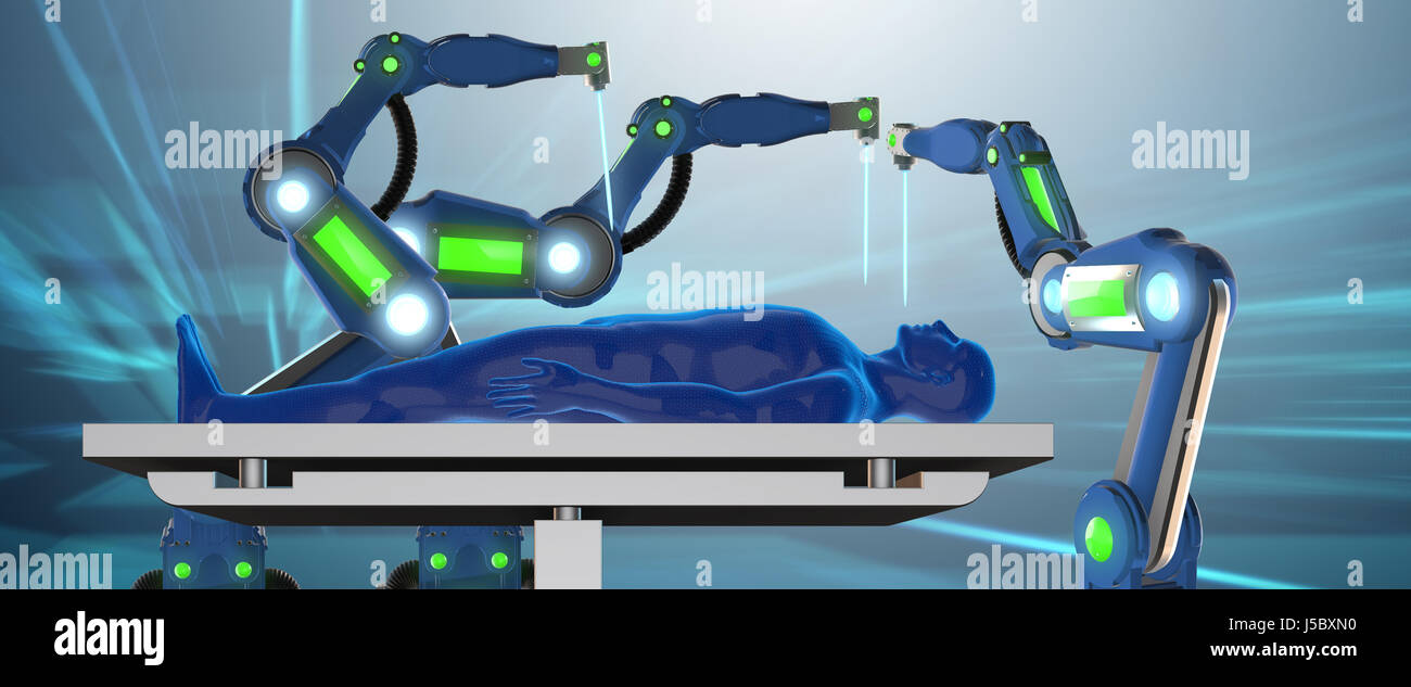 Surgery performed by robotic arm Stock Photo - Alamy