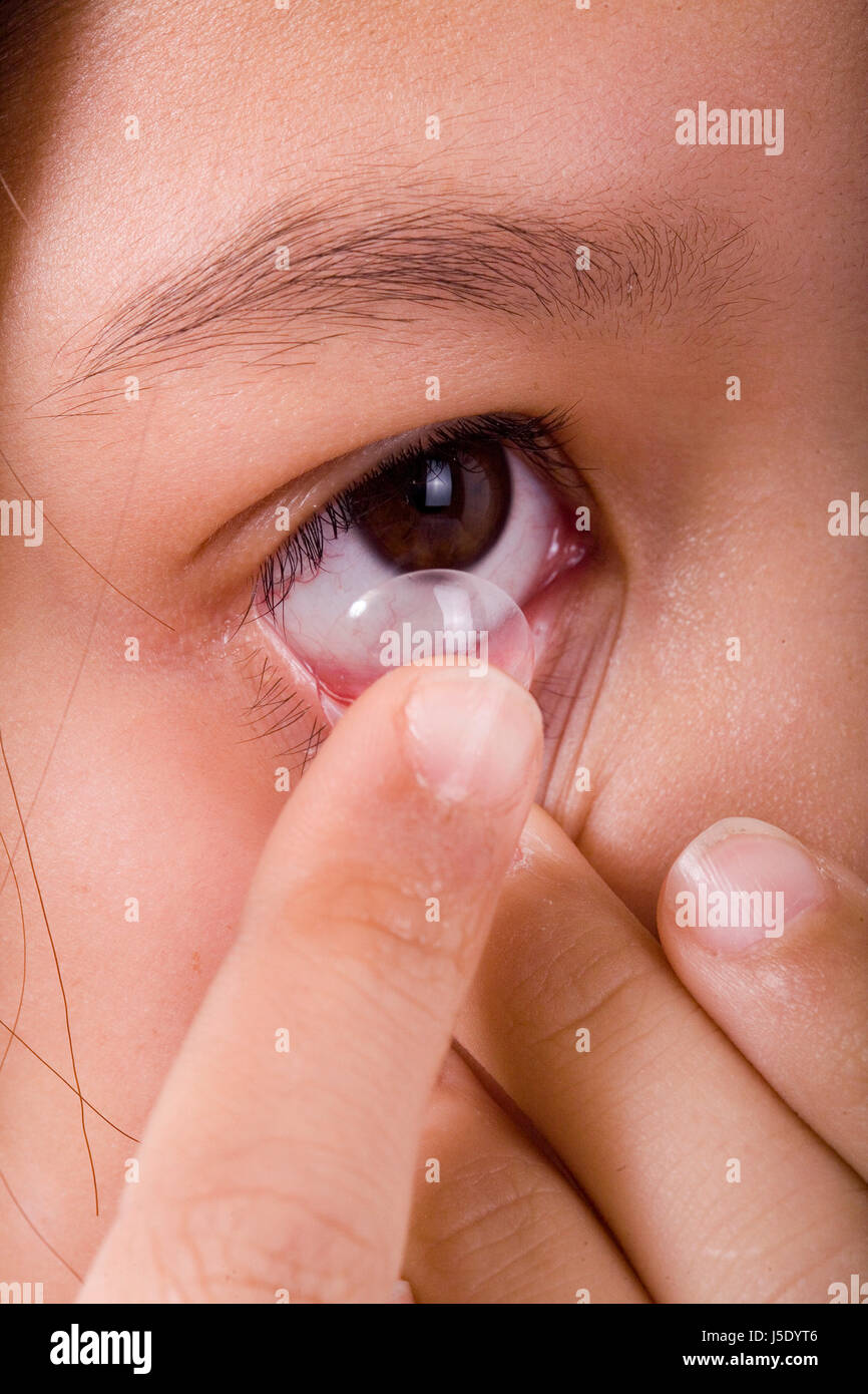 insertion of the contact lens Stock Photo - Alamy
