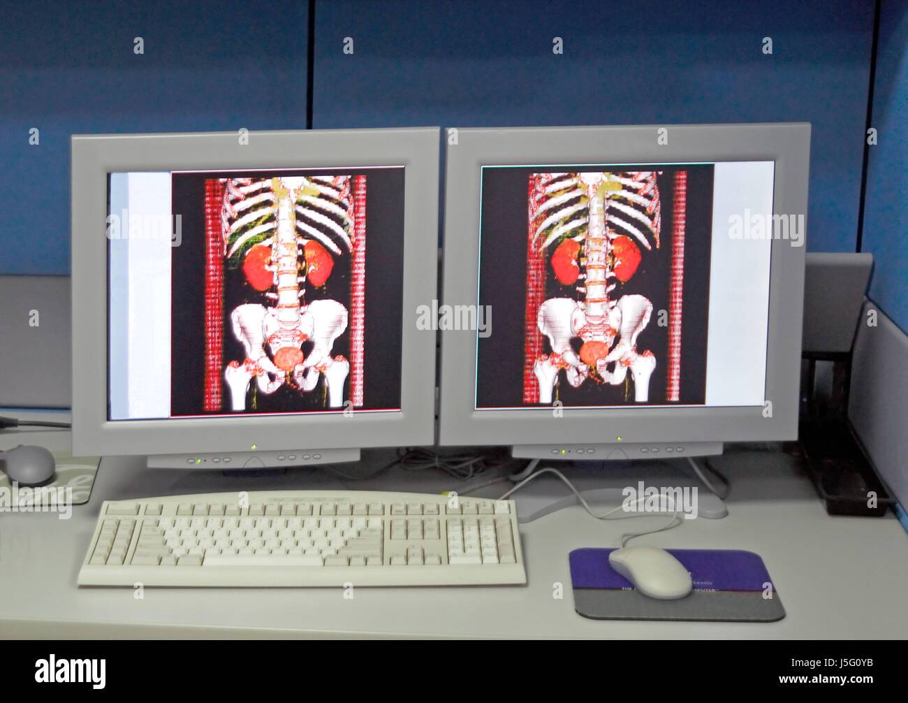 x-ray image in color Stock Photo - Alamy