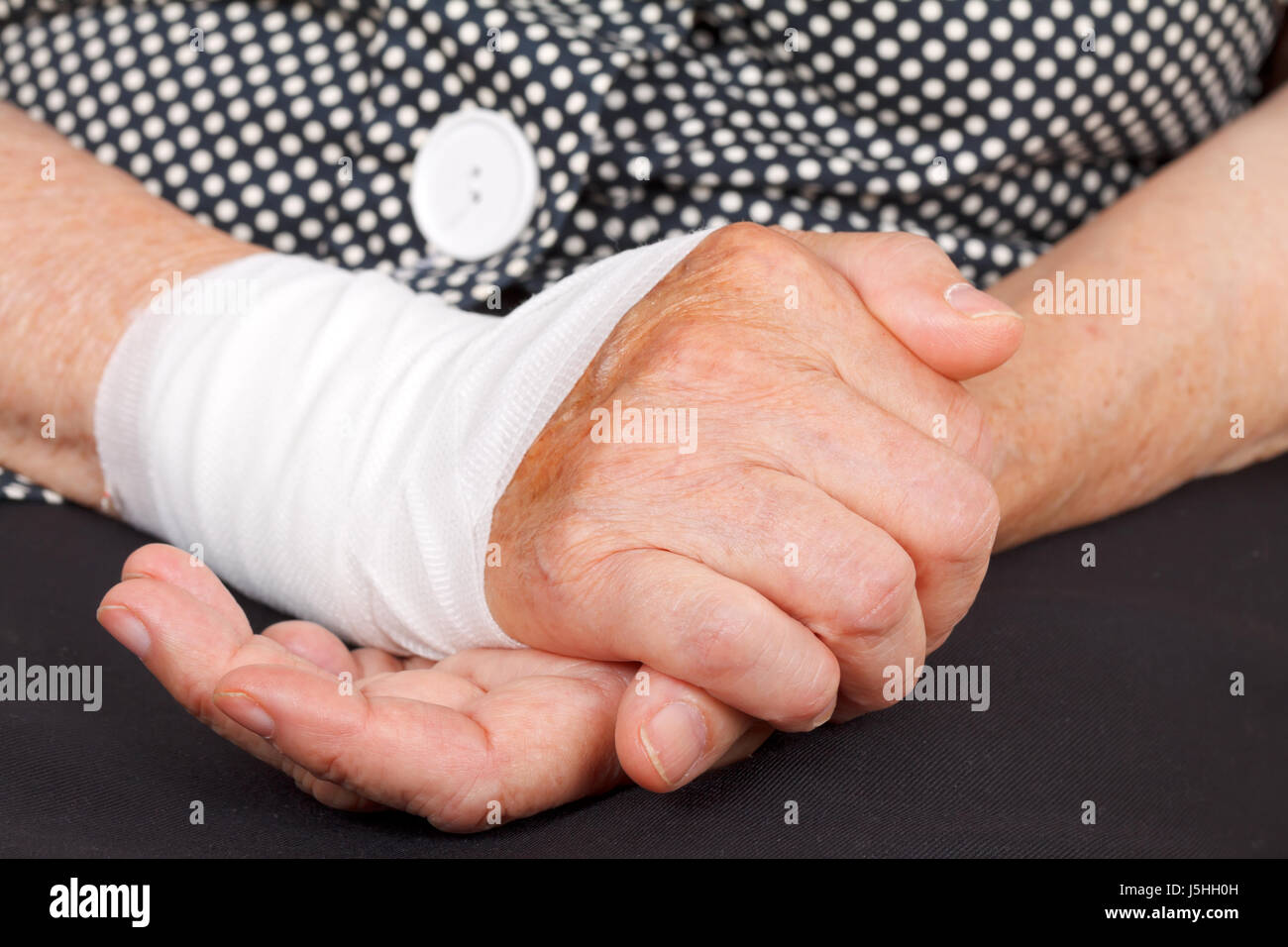 Contusion hi-res stock photography and images - Alamy