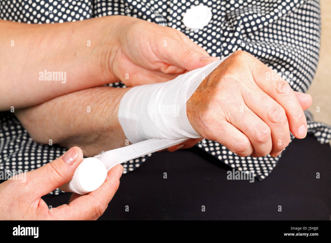 Contusion hi-res stock photography and images - Alamy