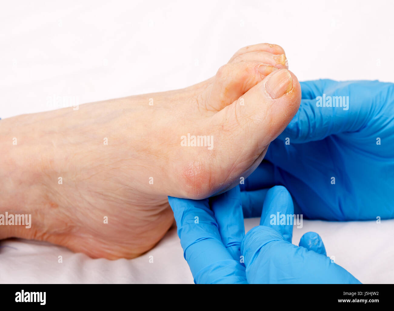 Doctor hand examining an elderly patient's foot Stock Photo - Alamy