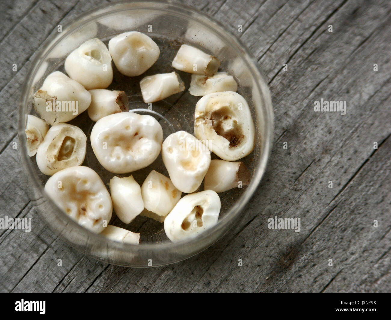 milk tooth collection Stock Photo - Alamy