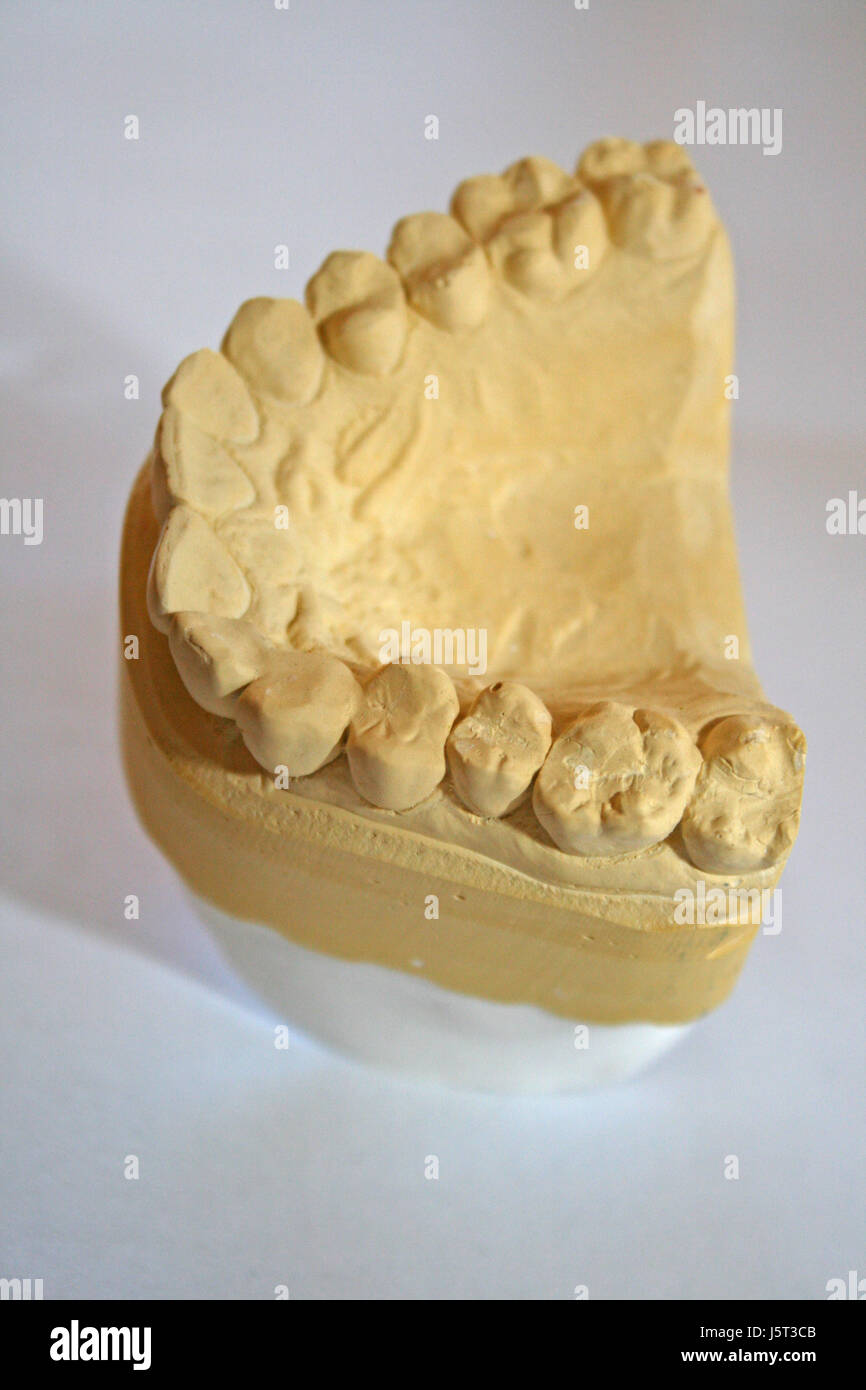 teeth bit dentist plaster cast teeth bit dentist pine fear tooth copy ...