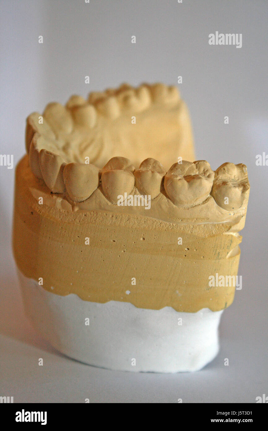 teeth bit dentist plaster cast teeth bit dentist pine fear tooth copy ...