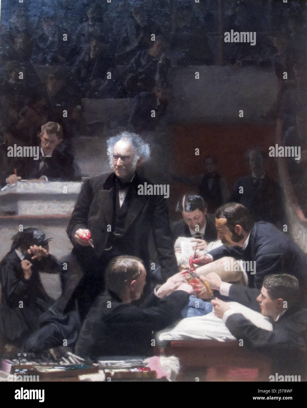 'The Gross Clinic' by Thomas Eakind is a famous painting from 1875 ...