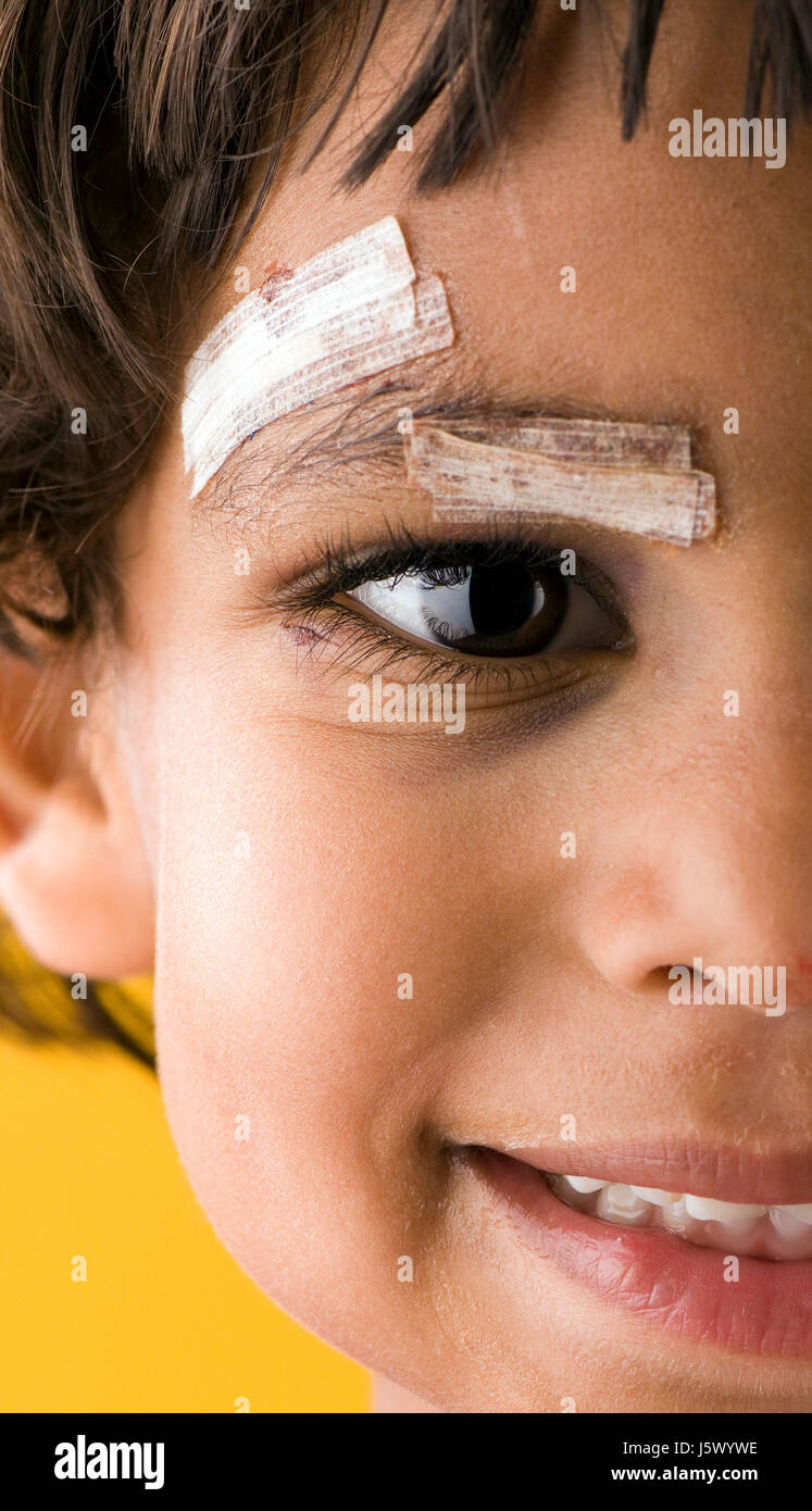 Black eye boy injury hi-res stock photography and images - Alamy