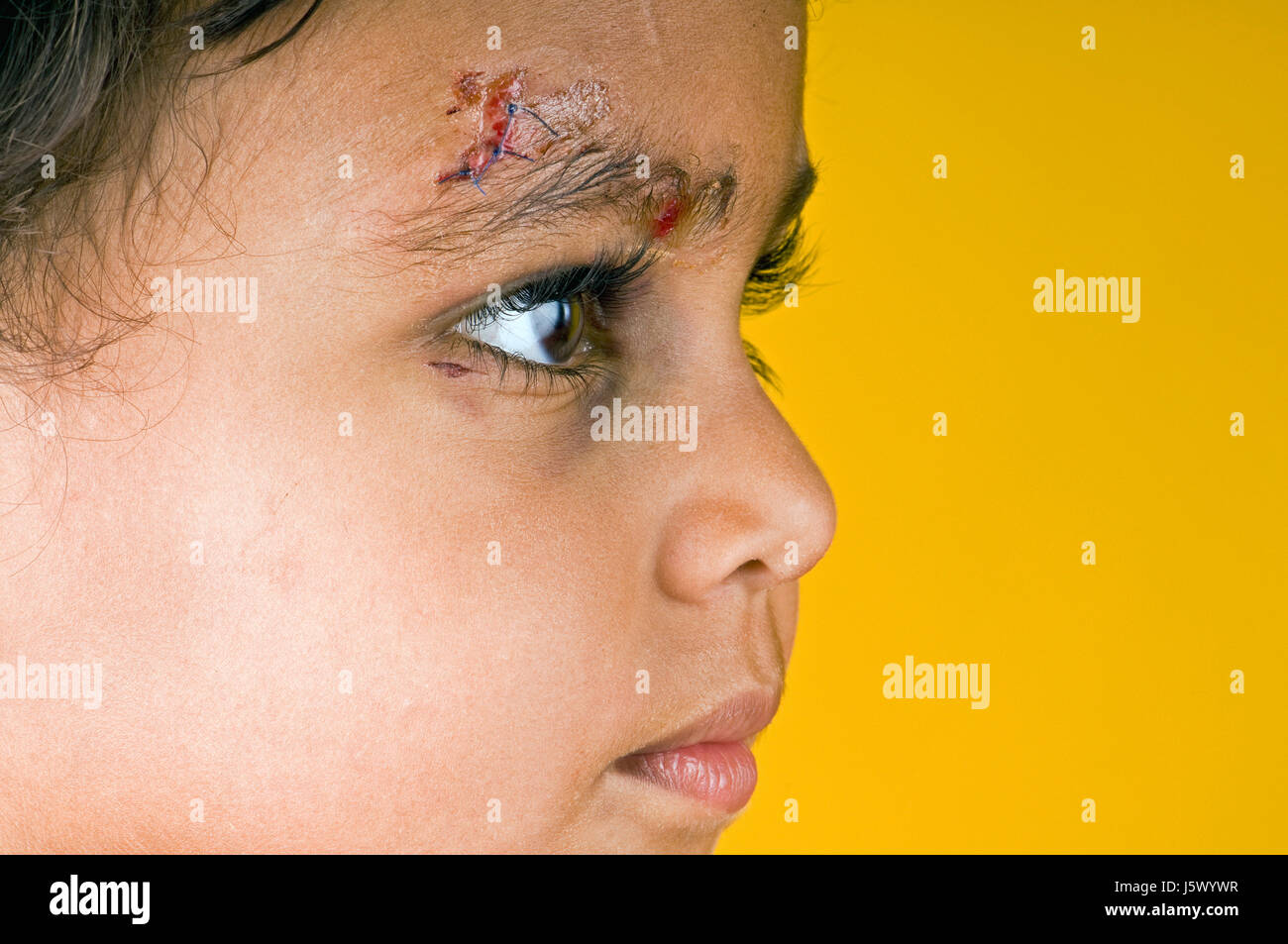 blossoms thread wound injury ache threads bleed seam boy lad male ...