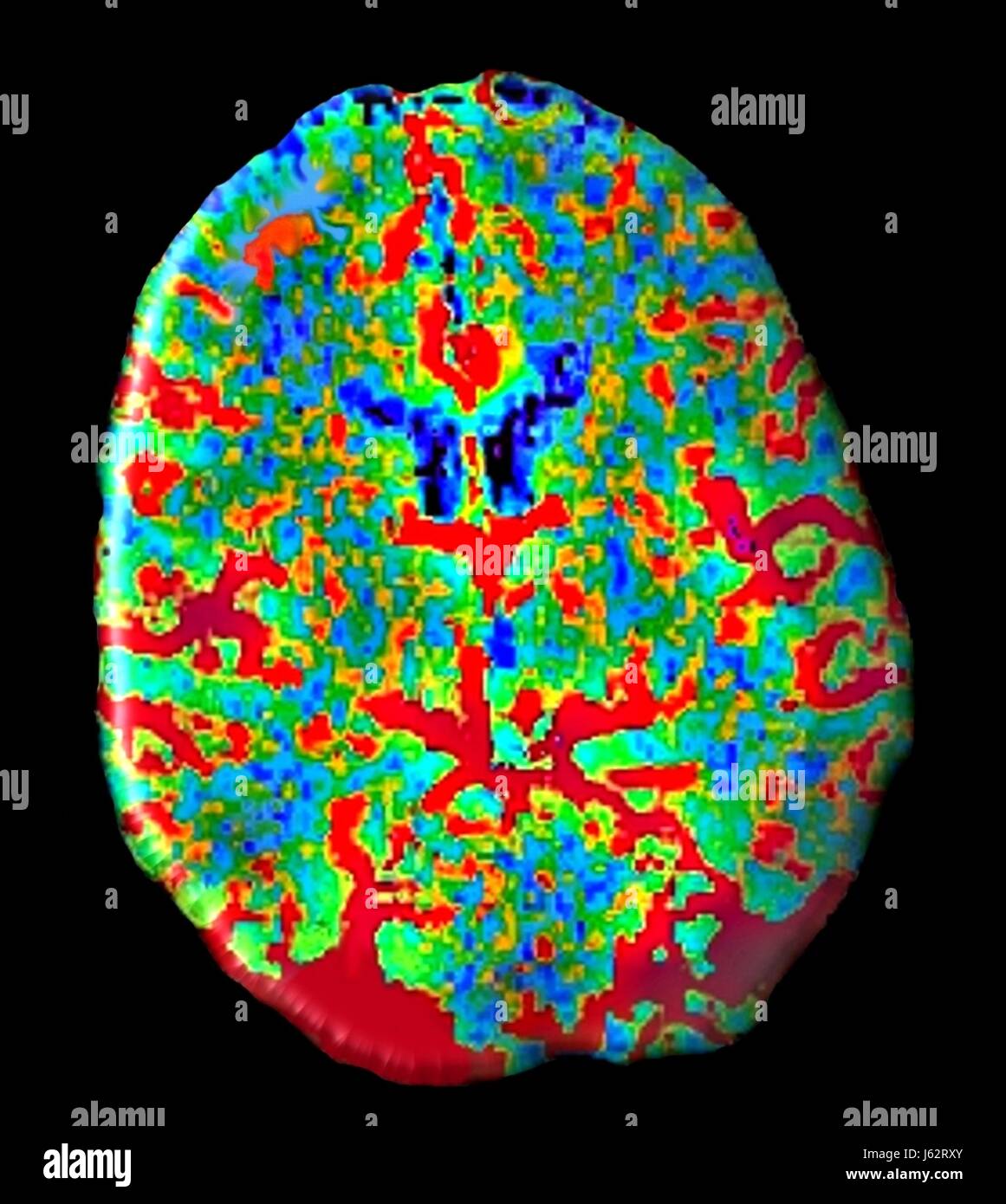 Neuroanatomie hi-res stock photography and images - Alamy