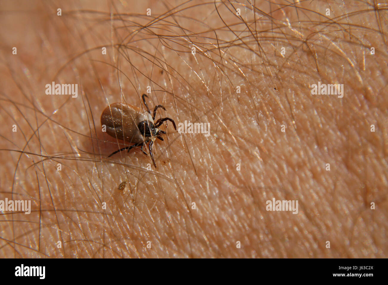 scrabble crawling skin human human being hairs structures tick sport ...