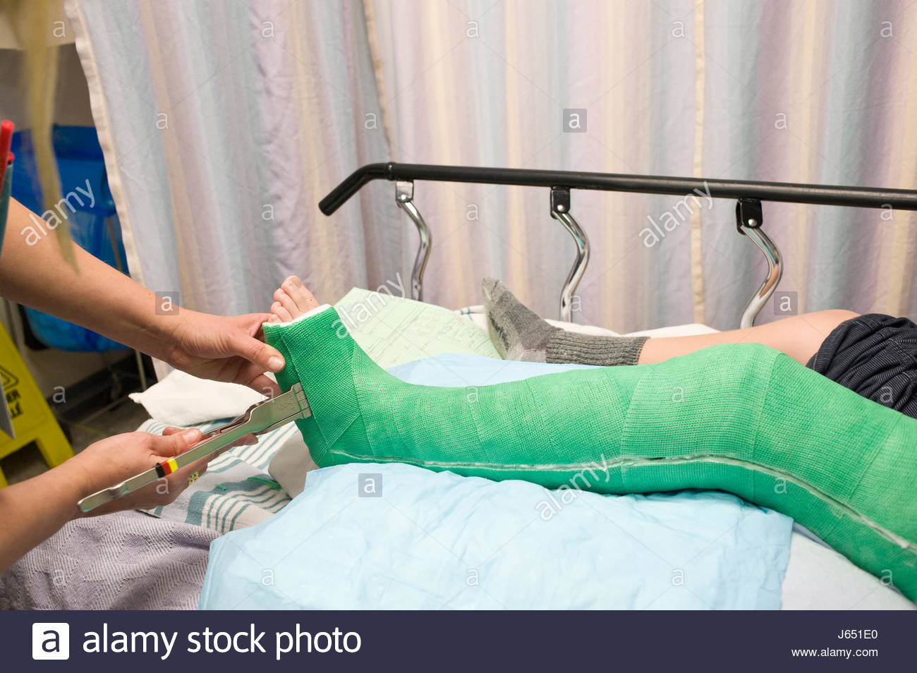Boy Child With Broken Leg High Resolution Stock Photography and Images ...