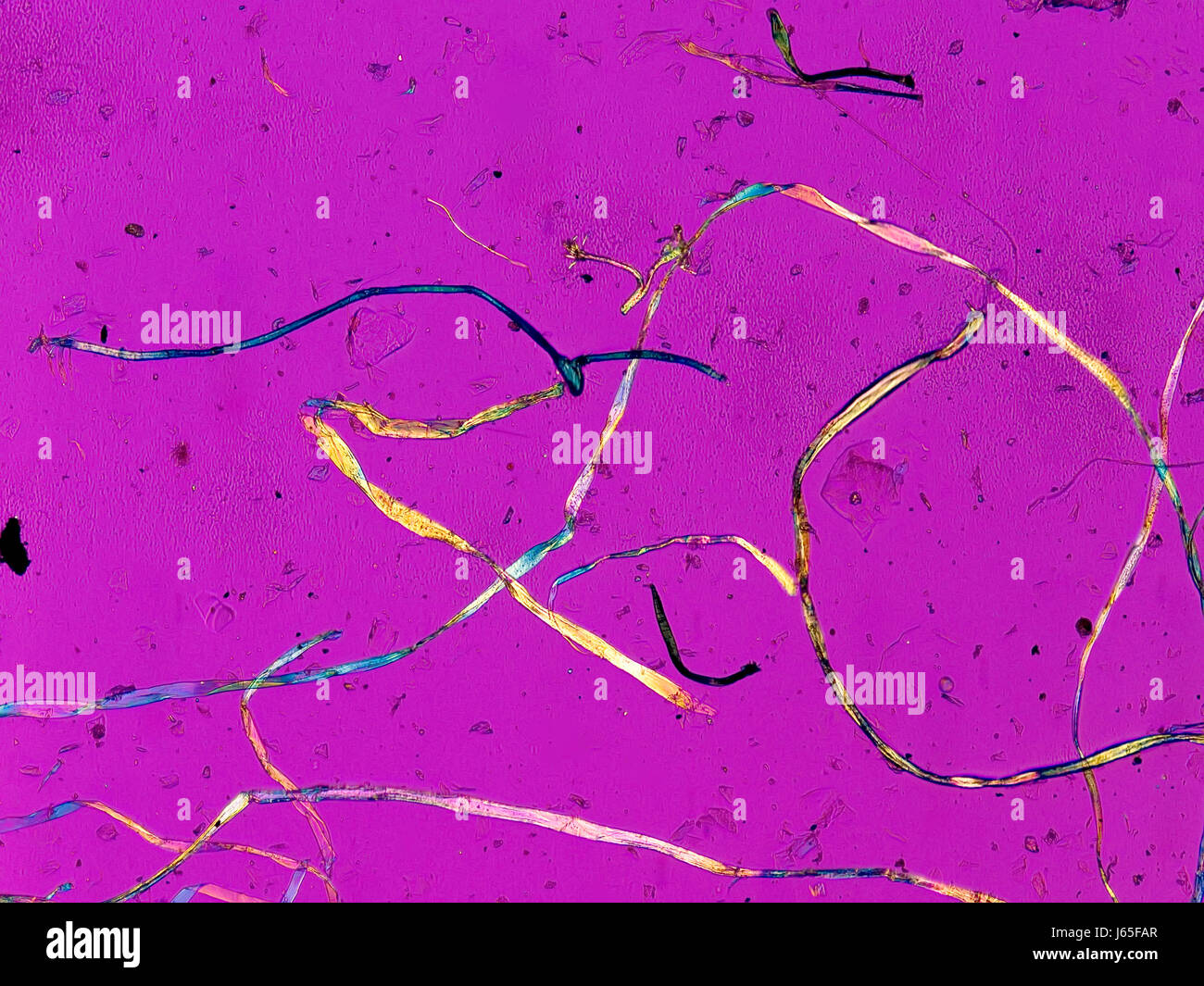 dust fibres fibers allergic allergies dust fibres fibers allergic ...