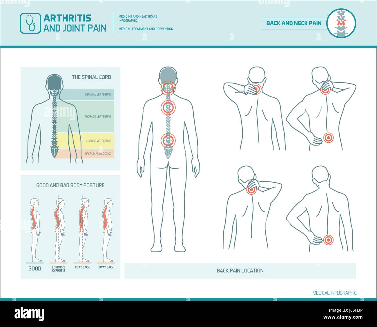 Back pain and body posture infographic with anatomical illustrations ...
