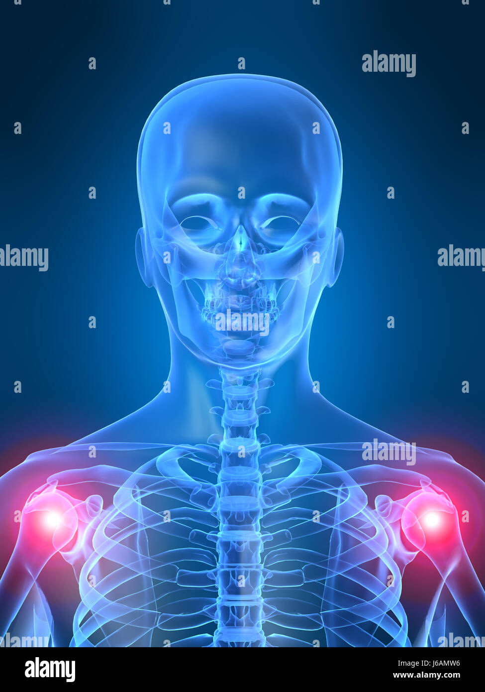health medicinally medical human human being pain skeleton anatomy ...