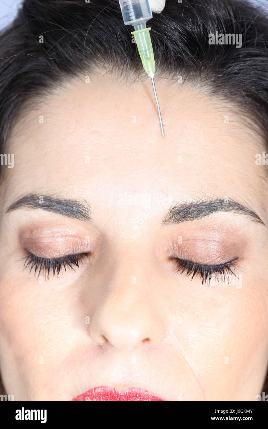 young woman gets botox injection Stock Photo - Alamy