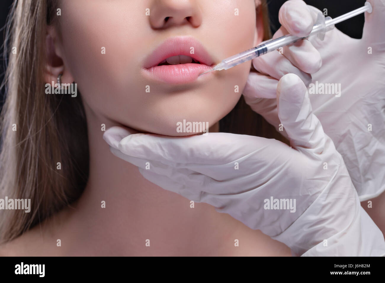 Portrait of young Caucasian woman getting cosmetic injection Stock ...