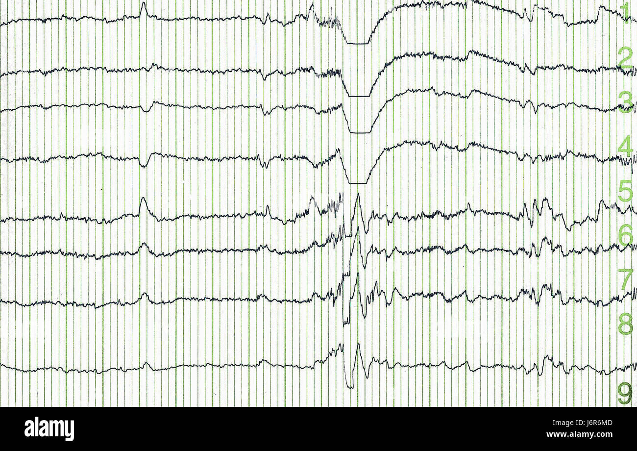 Eeg brain screen hi-res stock photography and images - Alamy