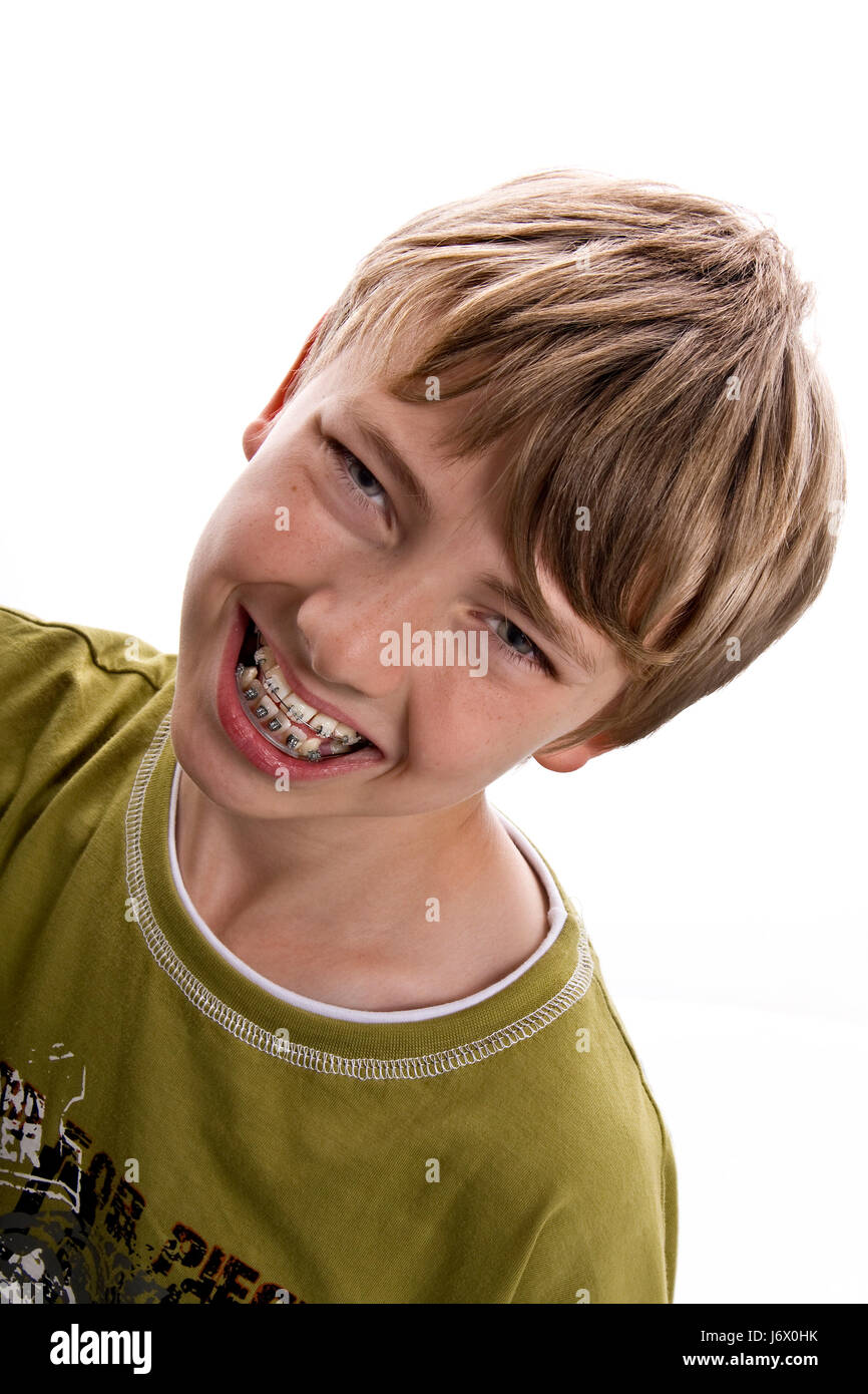 boy with braces 240610-2 Stock Photo - Alamy