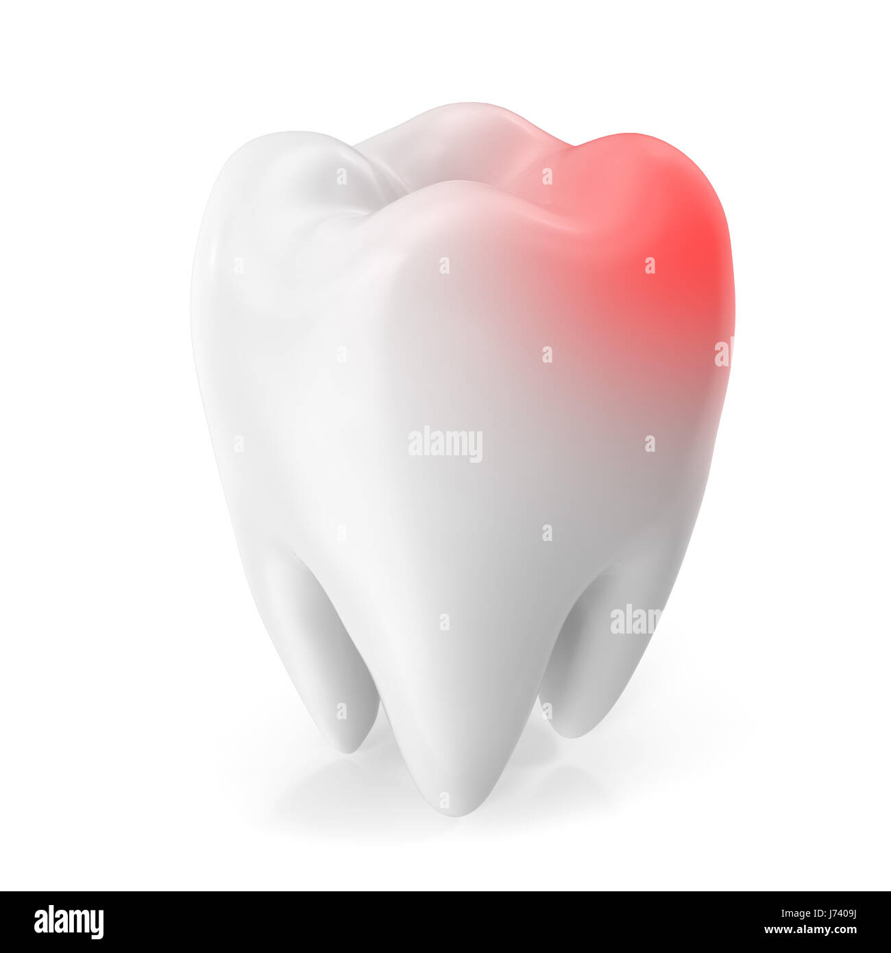 Toothache concept, caries concept isolated on white background, 3D ...