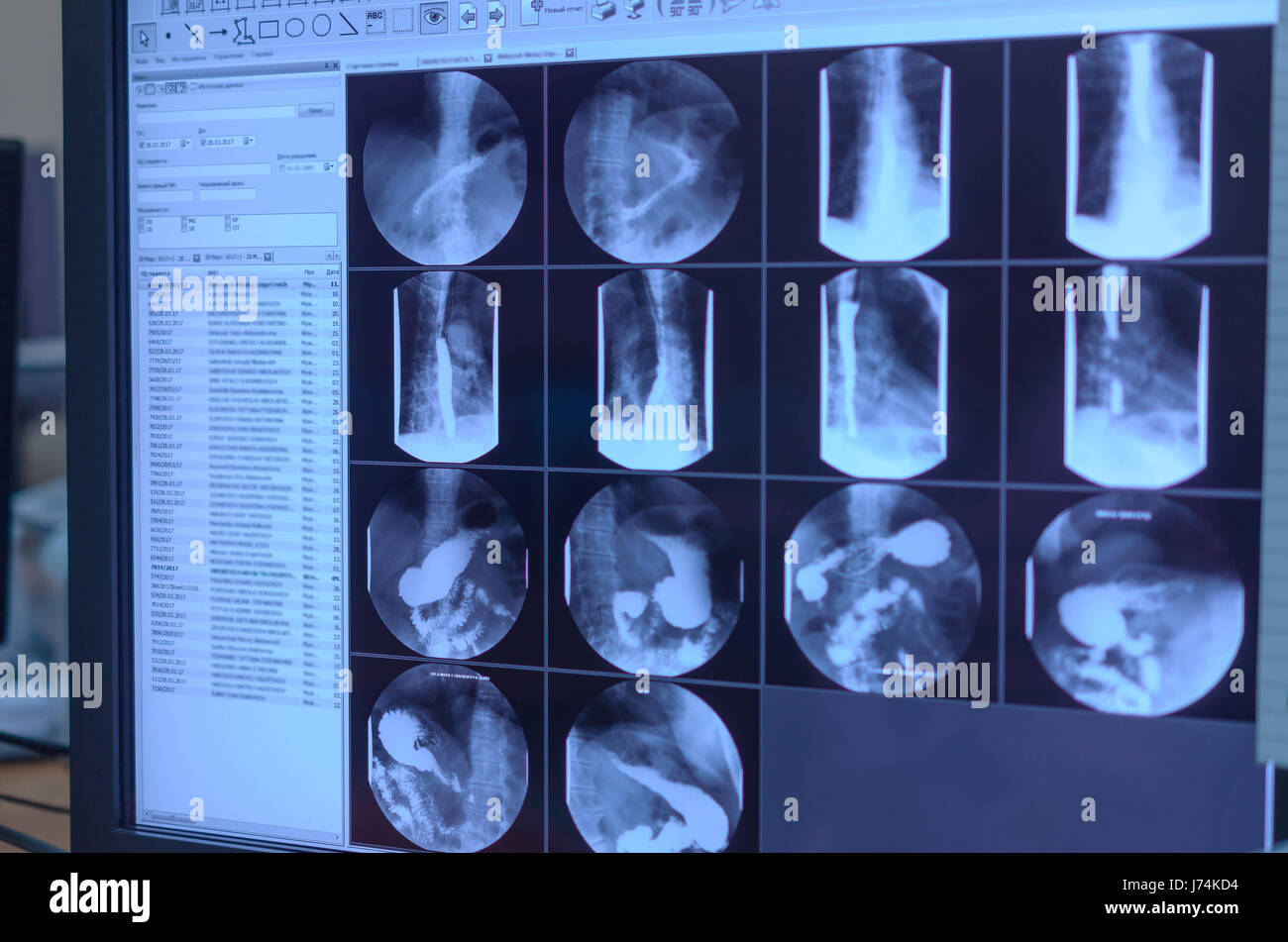 X-ray images as a result of patient diagnosis Stock Photo - Alamy