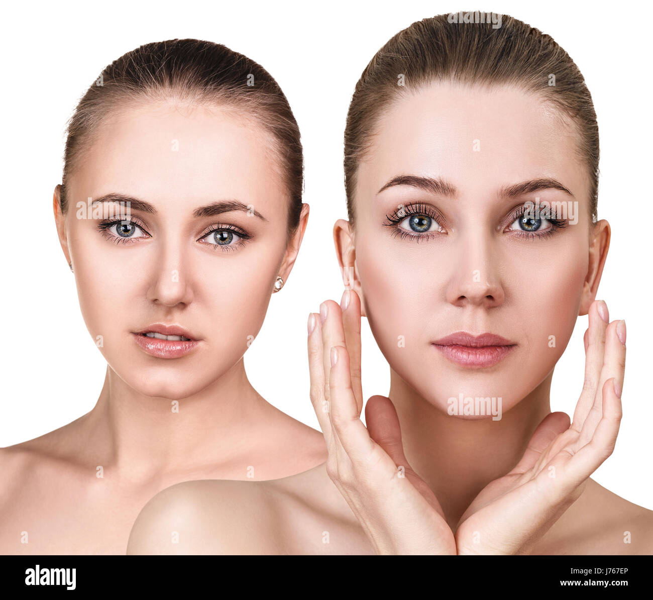 Cwo young women with healthy clear skin Stock Photo - Alamy