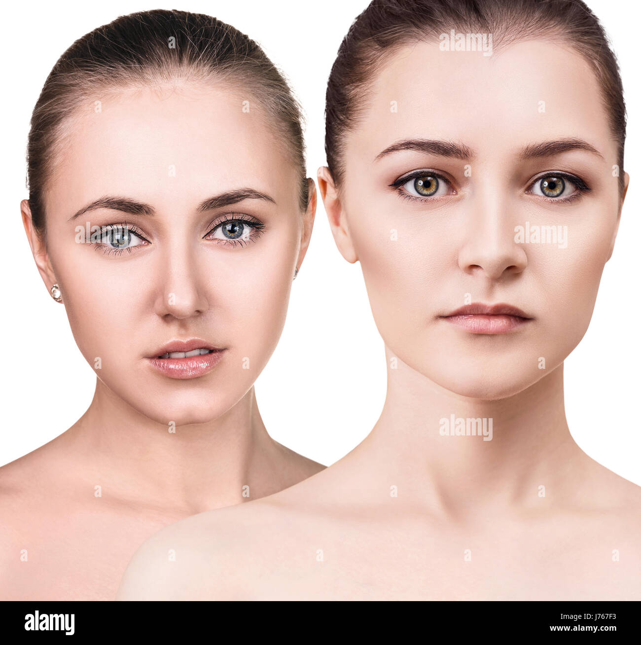 Cwo young women with healthy clear skin Stock Photo - Alamy