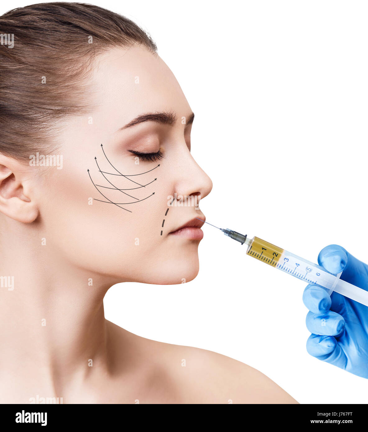 Beautiful woman gets injection in her lips Stock Photo - Alamy