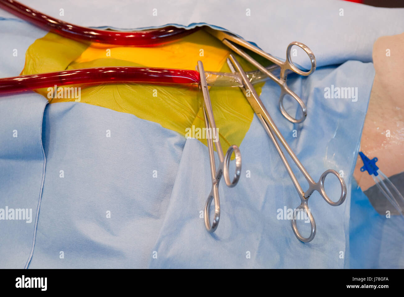 blood hose patient operation jam operate surgery operating theatre ...