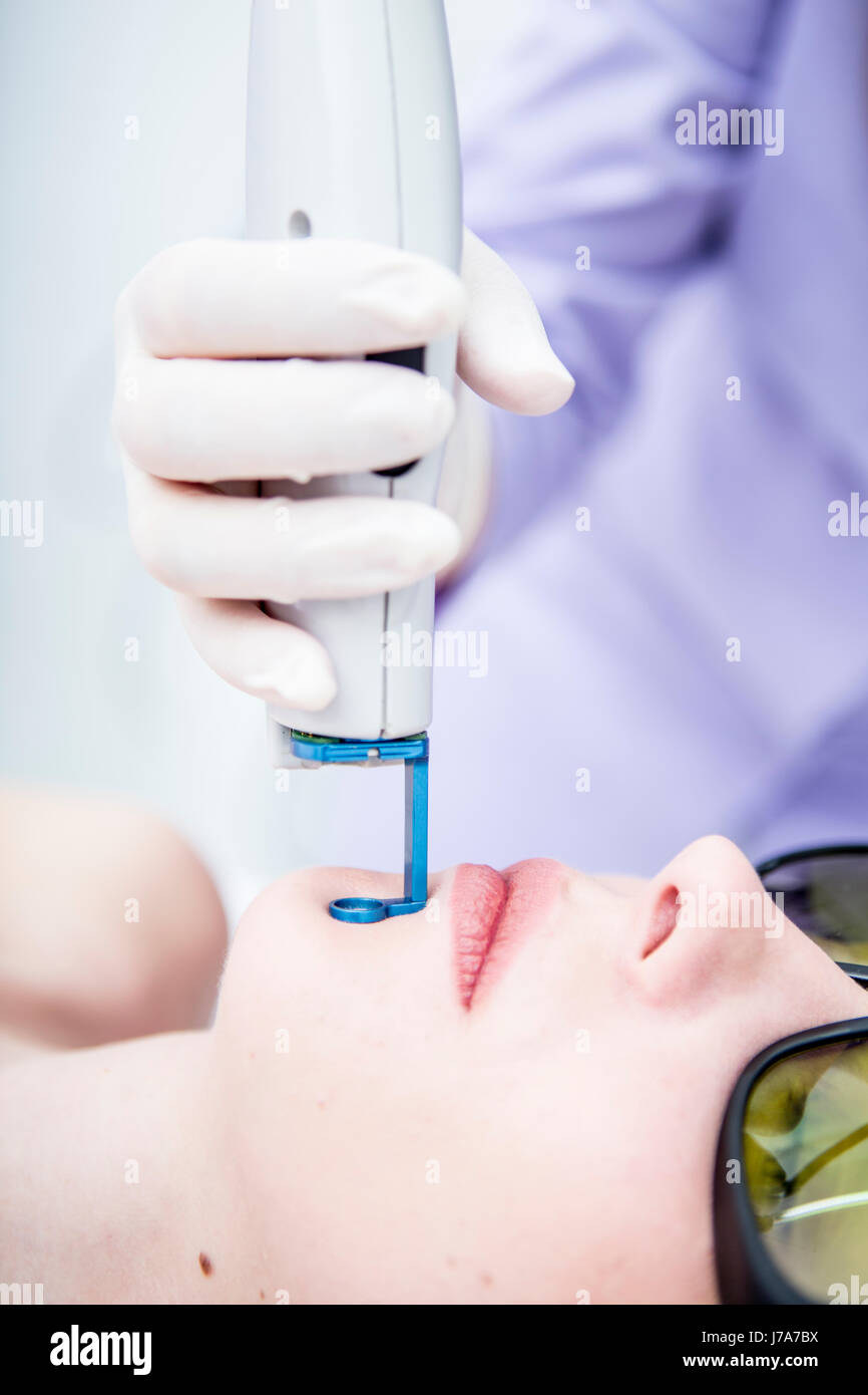 Aesthetic surgery, vascular laser treatment Stock Photo - Alamy