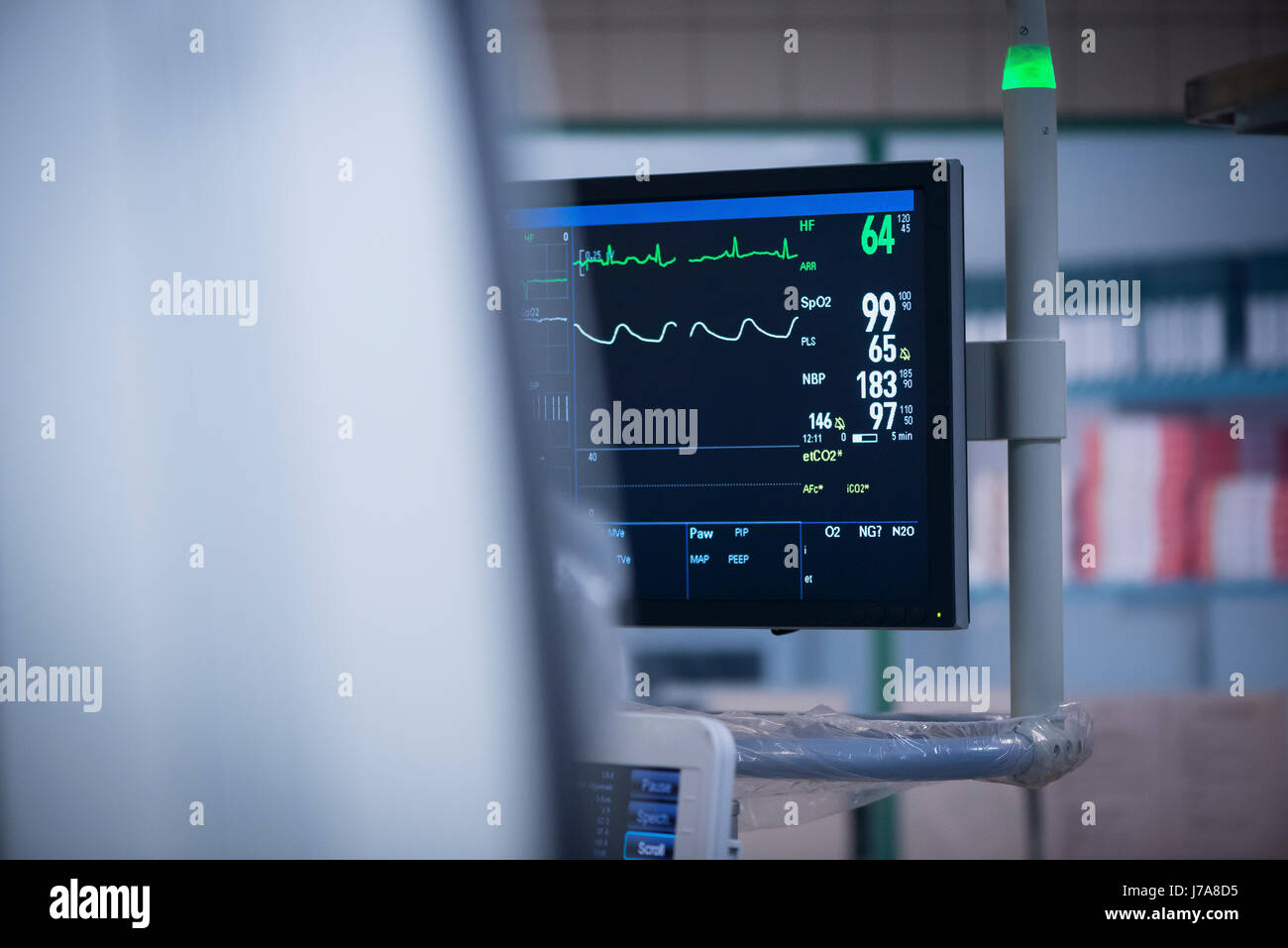 Anaesthesia monitor in catheter lab Stock Photo - Alamy