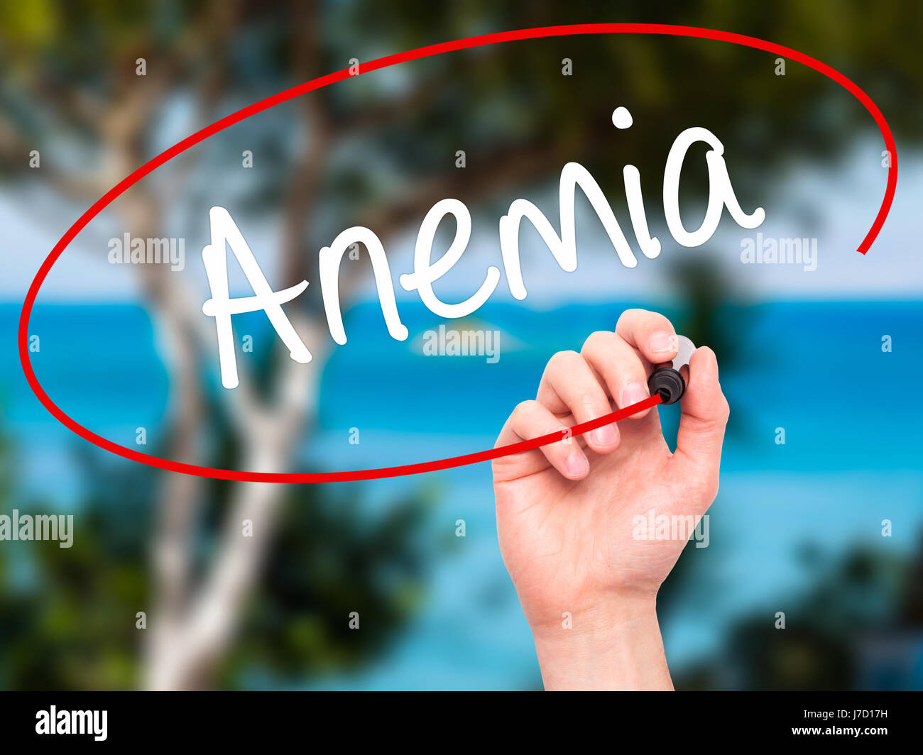 Man Hand writing Anemia with black marker on visual screen. Isolated on ...