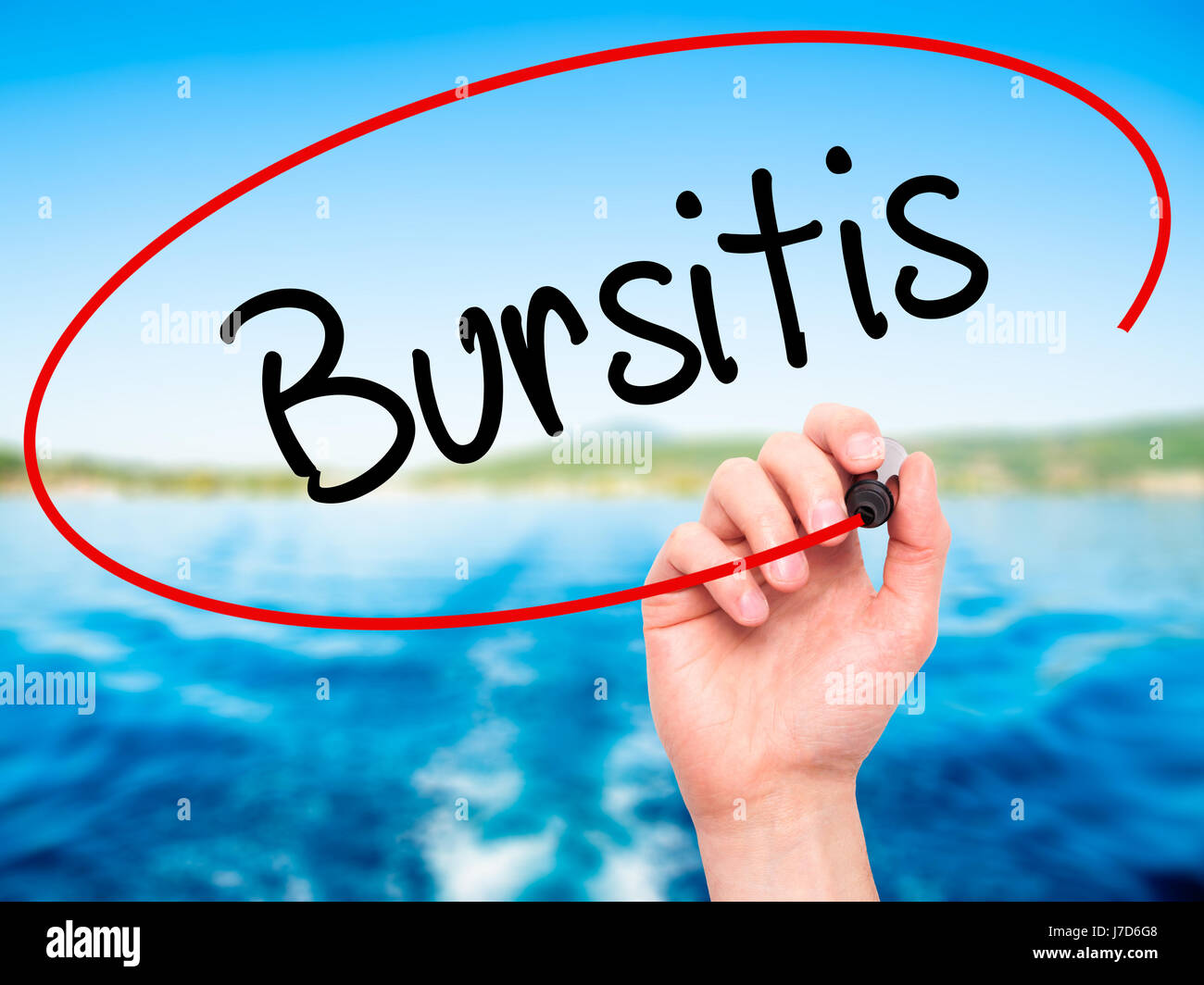 Man Hand writing Bursitis with black marker on visual screen. Isolated ...