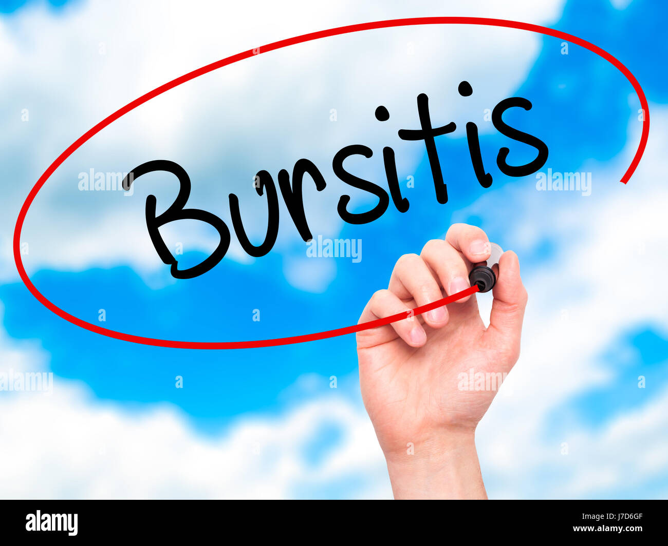 Man Hand writing Bursitis with black marker on visual screen. Isolated ...