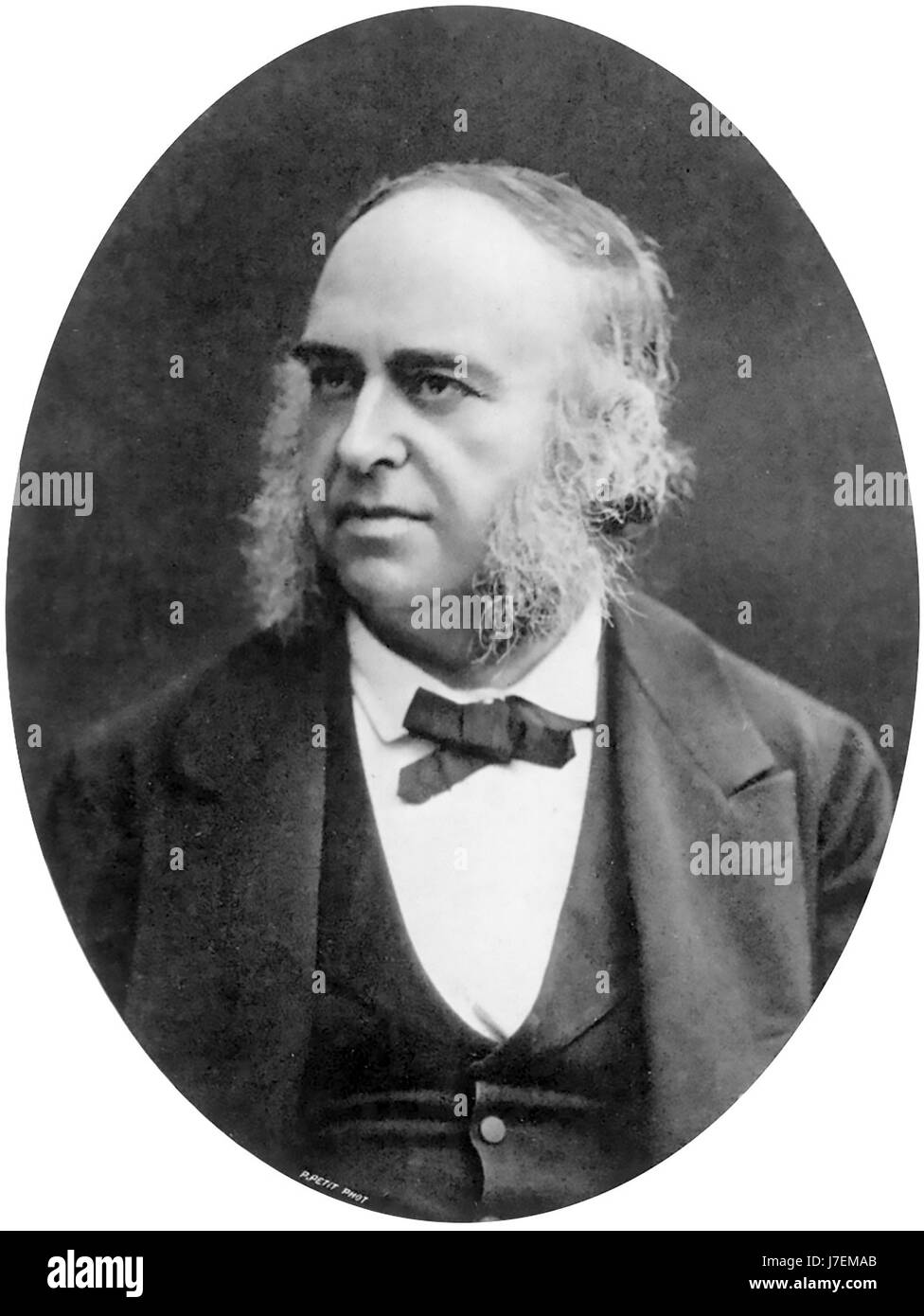 Brocas area hi-res stock photography and images - Alamy