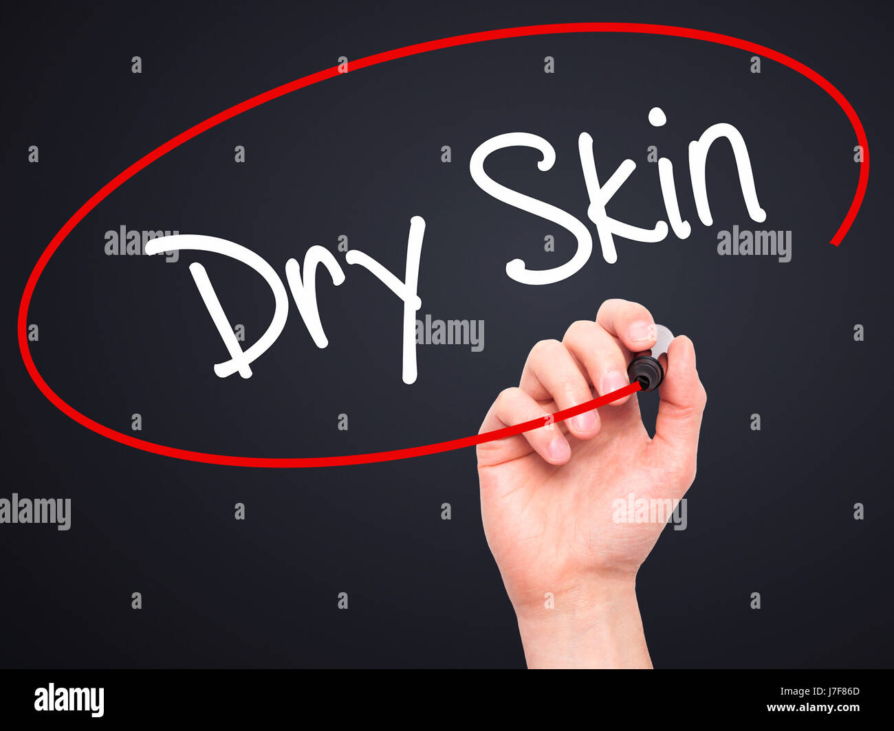 Man Hand writing Dry Skin with black marker on visual screen. Isolated ...