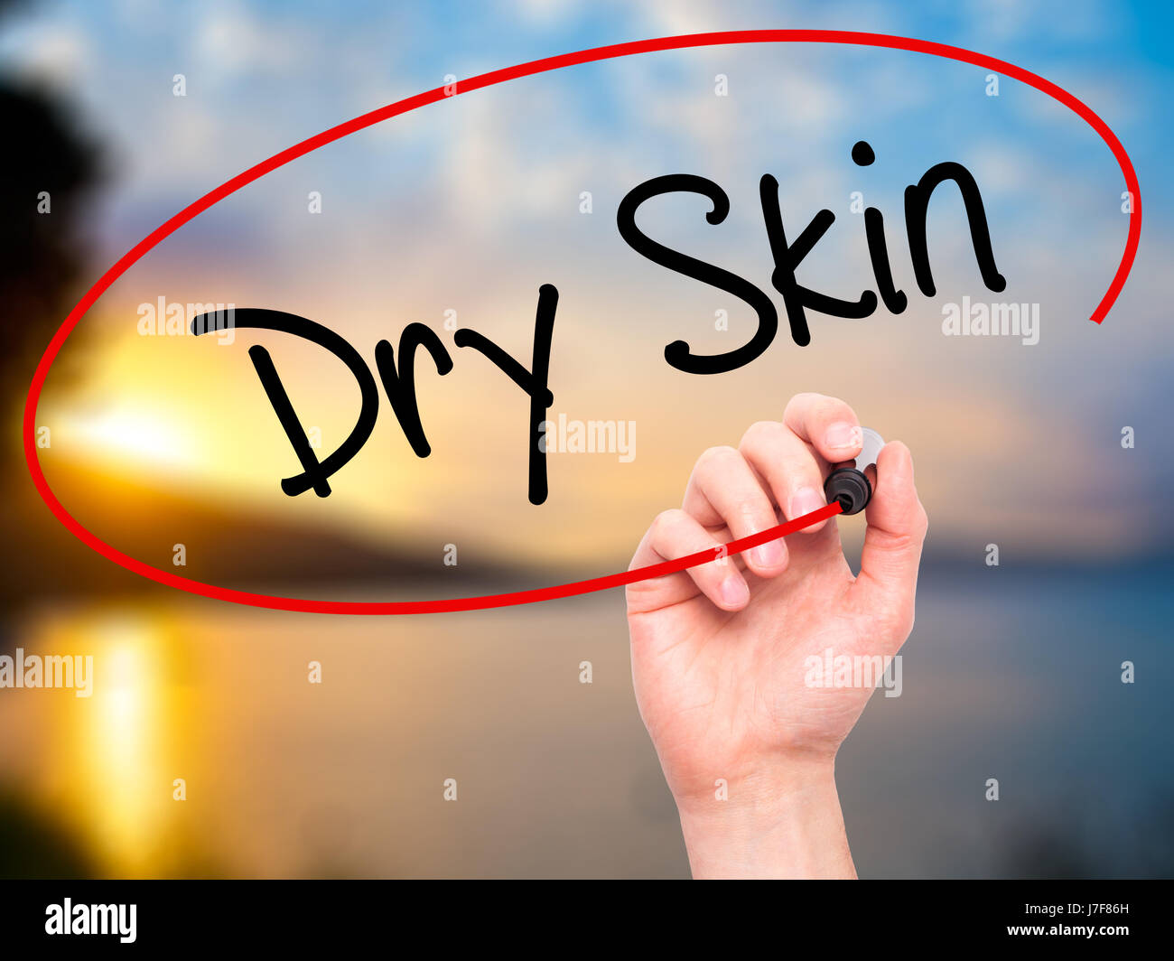 Man Hand writing Dry Skin with black marker on visual screen. Isolated ...