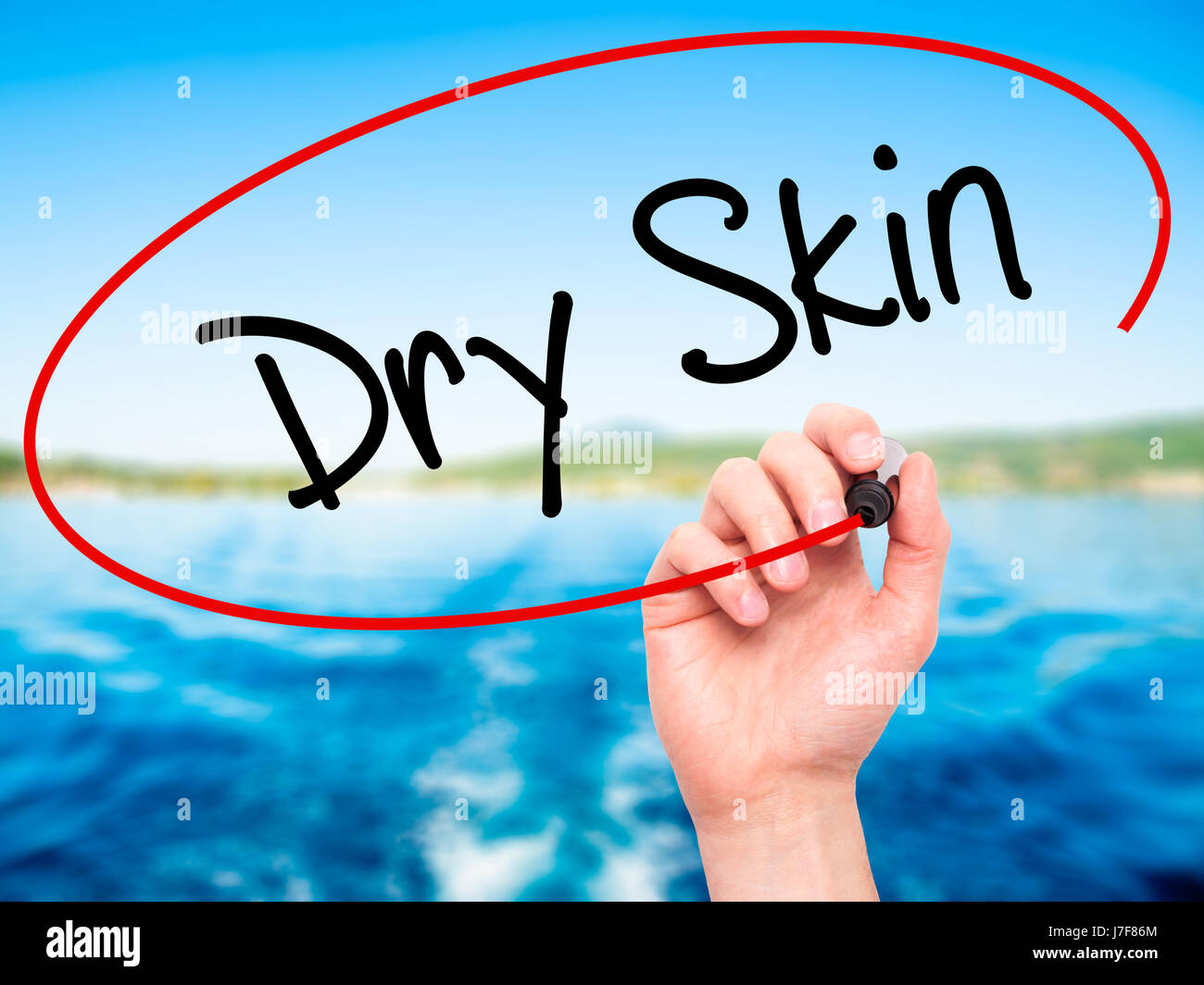 Man Hand writing Dry Skin with black marker on visual screen. Isolated ...