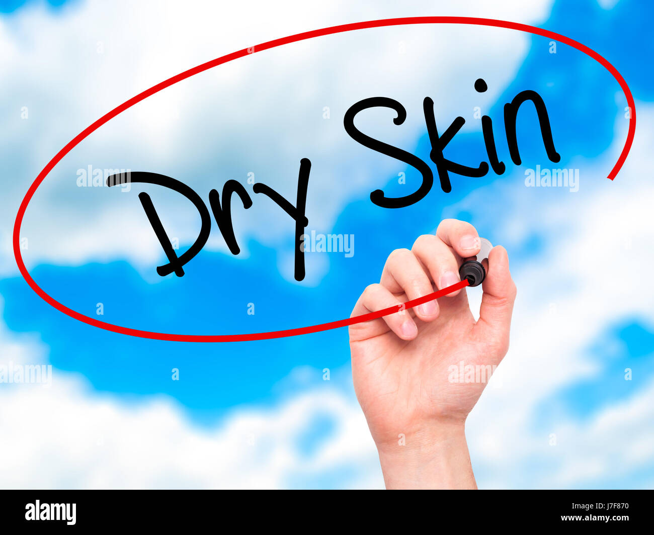 Man Hand writing Dry Skin with black marker on visual screen. Isolated ...