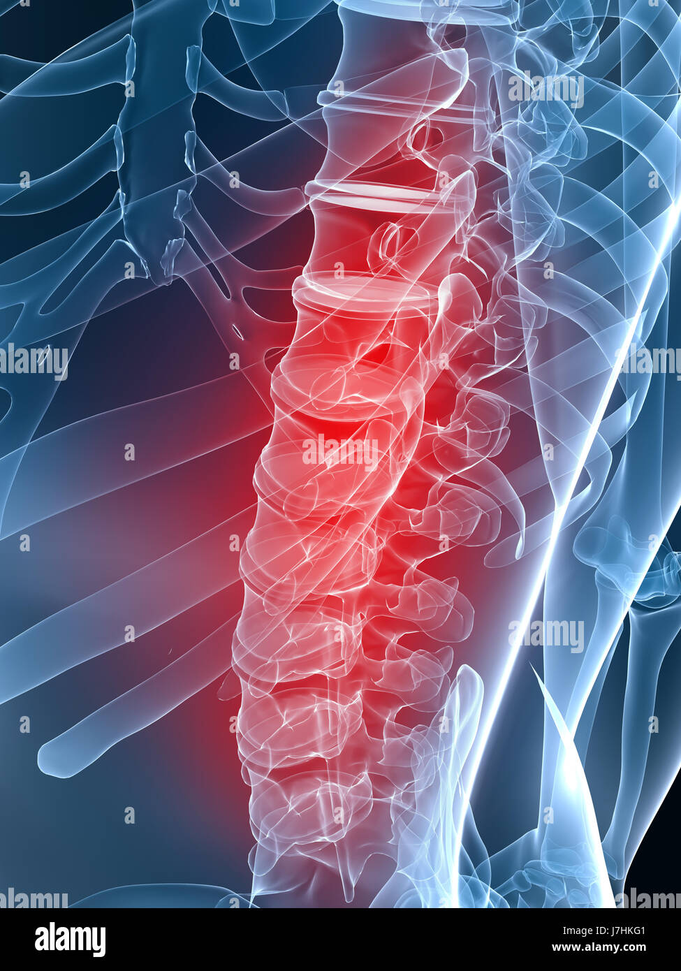 health human human being skeleton anatomy spine backache arthritis ...