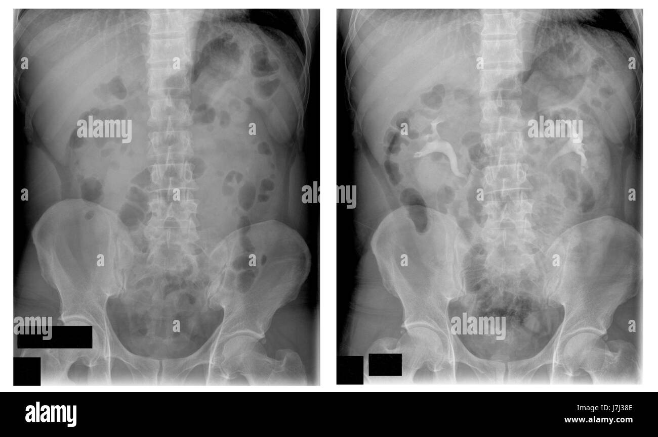 medicinally medical science human human being clinic bone radio shot ...