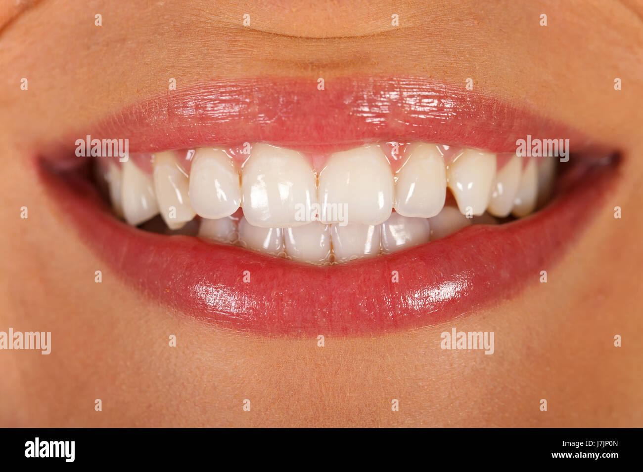 Close up picture of a young woman's beautiful denture Stock Photo - Alamy
