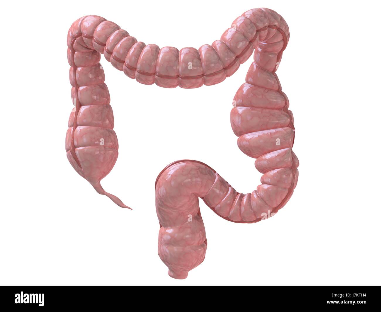 Health cancer anatomy polyp hi-res stock photography and images - Alamy