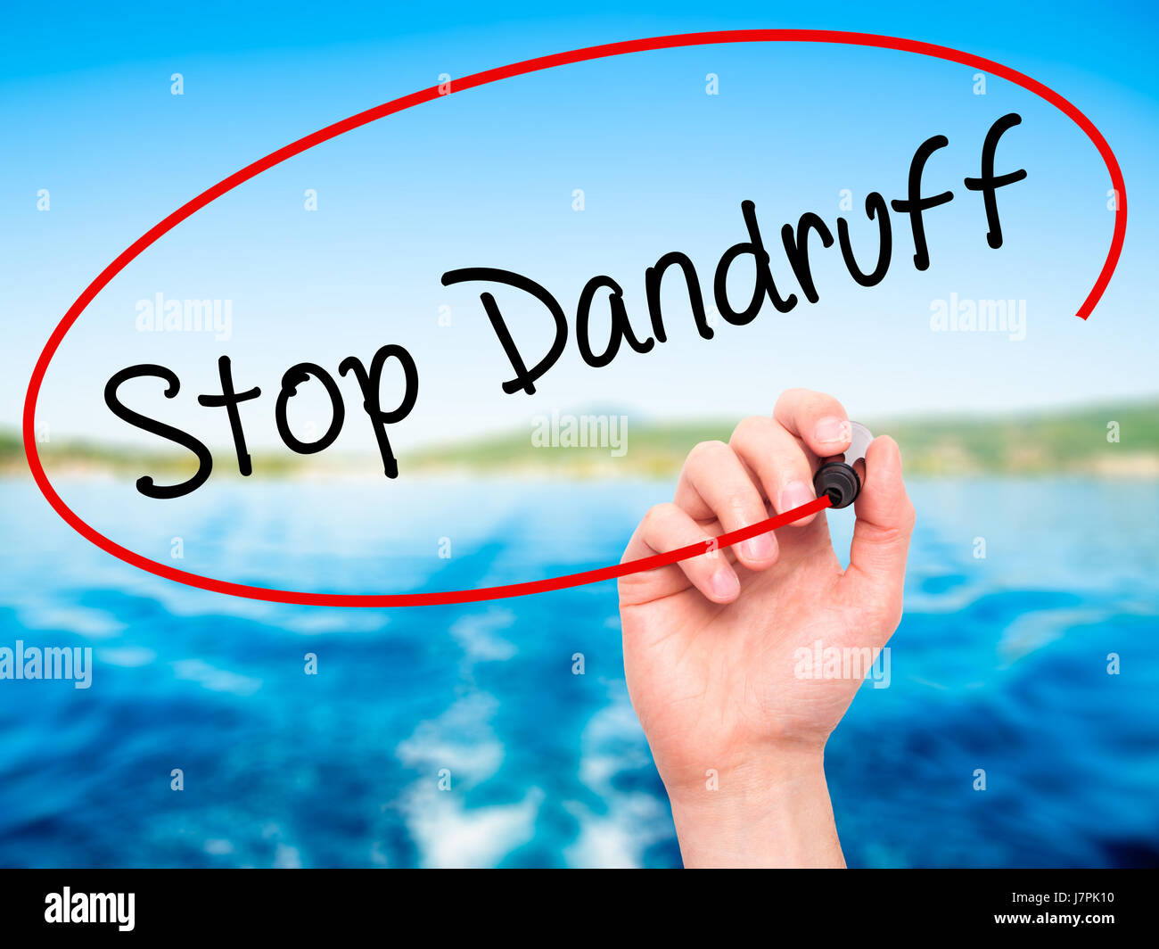 Man Hand writing Stop Dandruff with black marker on visual screen ...
