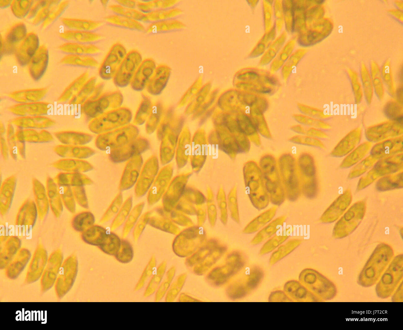 Scenedesmus sp. is a genus of freshwater algae. These organisms are ...
