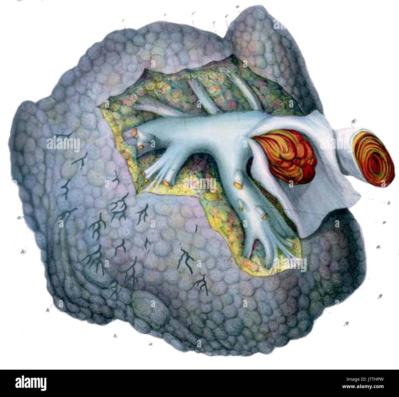 Carswell pathology hi-res stock photography and images - Alamy