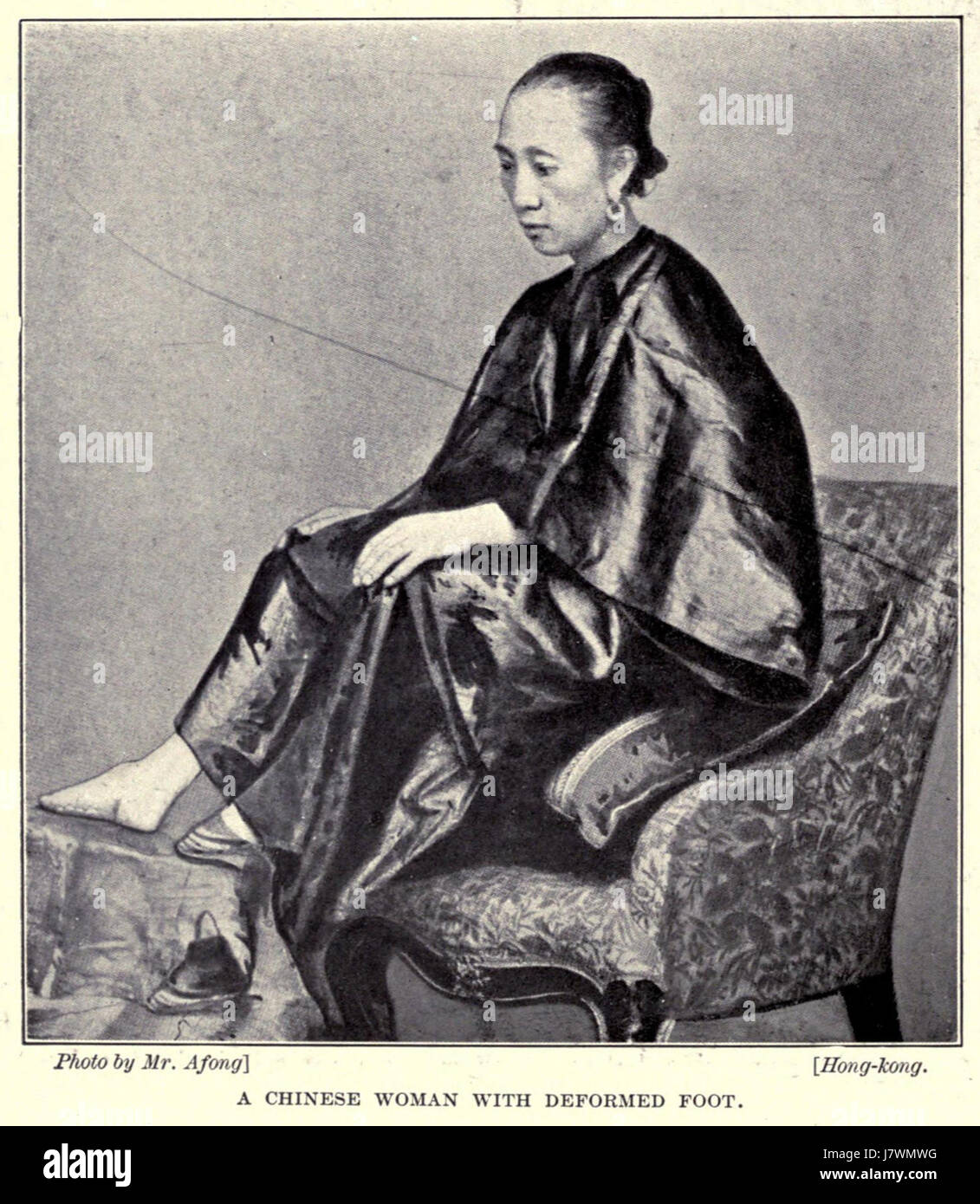 Footbinding hi-res stock photography and images - Alamy